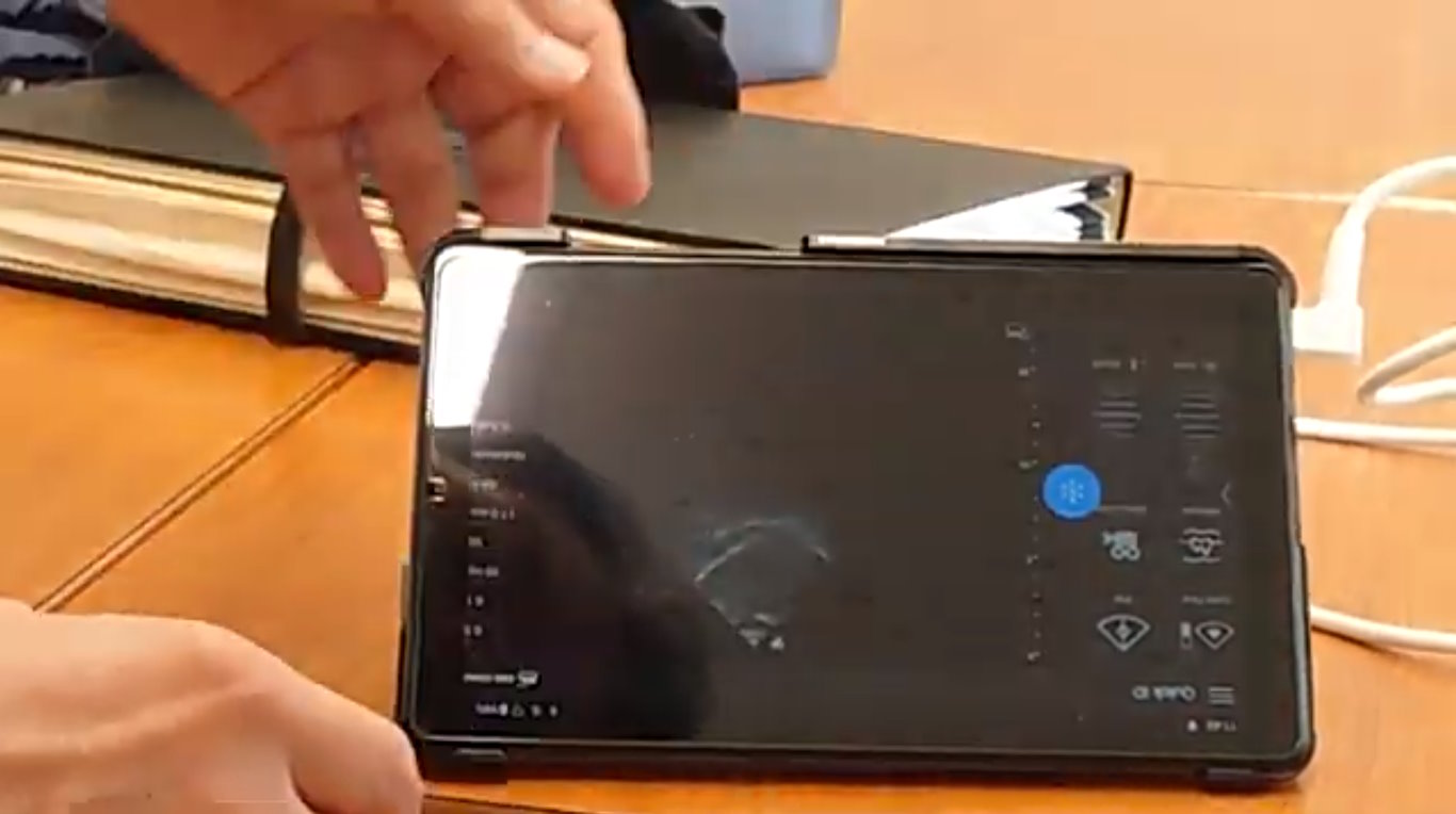 発音する時の舌の動きを医療用エコーを使って確認する実験 - shin MIC